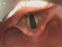 Airway Assessment | OpenAirway