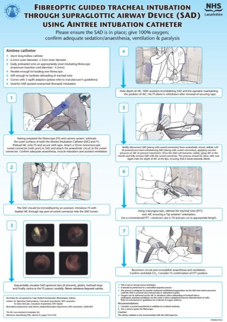 Video: Aintree intubation technique | OpenAirway